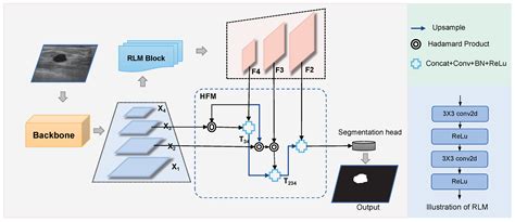 Diagnostics Free Full Text Swin Net A Swin Transformer Based