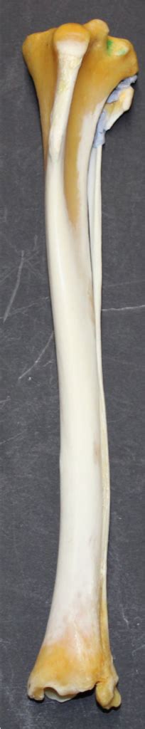 Diagram Of Tibia Cranial Aspect Quizlet