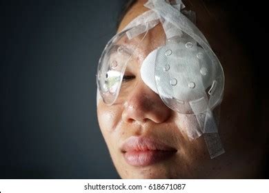 Safety Eye Shield Images Stock Photos Vectors Shutterstock