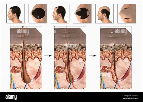Blood Supply Of The Scalp Hi Res Stock Photography And Images Alamy
