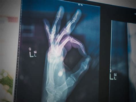 Maintaining Bone Health A Guide To Checking Your Bone Density Nirog