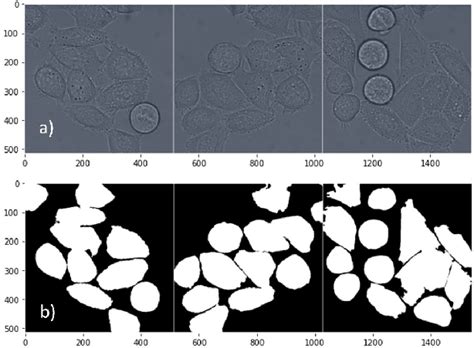 Deep Learning Based Bio Medical Image Segmentation Using UNet Architecture And Transfer Learning