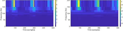 Figure 1 From Semg Feature Extraction Using Generalized Discrete