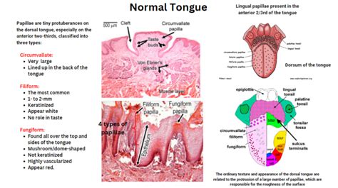 Atrophic Glossitis • The Blood Project