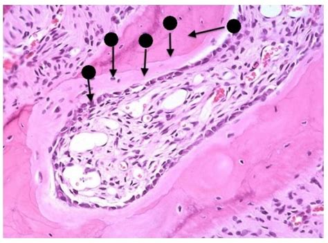 Ap Final Bone Resorption Image Diagram Quizlet
