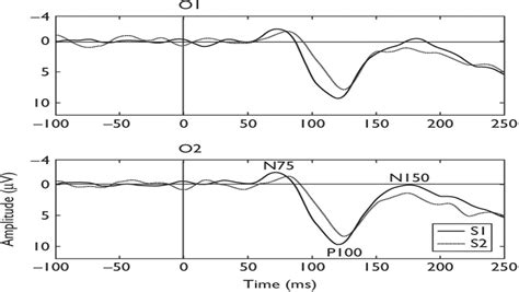 Electroencephalographic Evidence Of Sensory Gating In The Oc Neuroreport