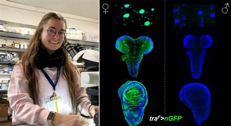 Sexual Identity Is Perceived And Acting In Somatic Tissues With Chloé Hérault Ibv