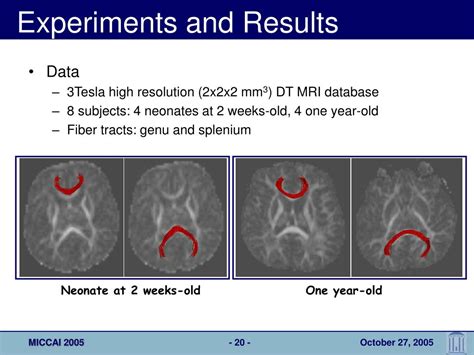Ppt Clinical Use Of Dti Powerpoint Presentation Free Download Id3024133