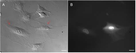 The Influence Of Microinjection Parameters On Cell Survival And Procedure Efficiency Pmc