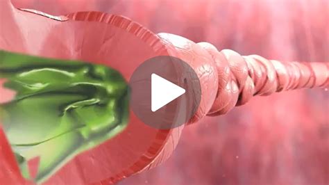 Airways With Asthma 3d Animation Asthma Australia