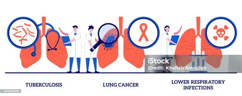 결핵 폐암 작은 사람들과 낮은 호흡기 감염 개념 폐 질환 벡터 일러스트 세트 증상 및 진단 종양학 종양 위험 인자 폐렴 은유 개념에 대한 스톡 벡터 아트 및 기타 이미지