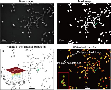 Segmentation Of The Clustered Cells Using The Watershed Method A Raw Download Scientific