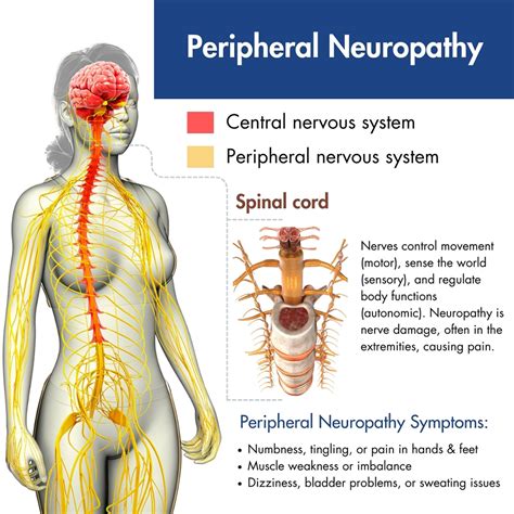 Peripheral Neuropathy Treatmentmadison Wi Pro Spine And Pain