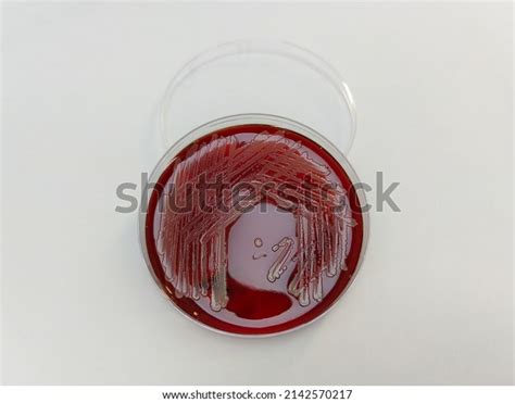 Mrsa Staphylococcus Aureus Grampositive Gramvariable Nonmotile Foto