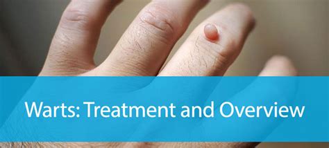 Best Sexologist Doctor Best Online Sexologists Treatment For ED Orgasmic Issues Hashmi