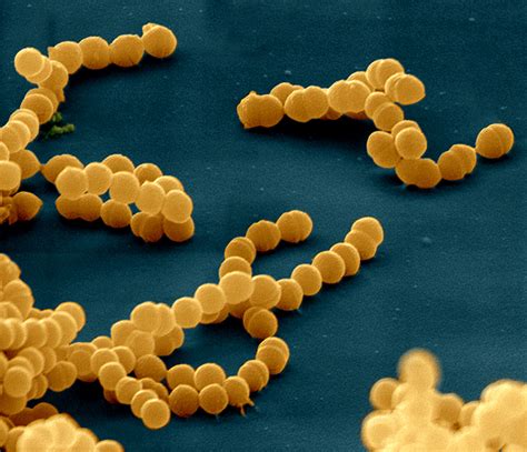 Streptococcus Pyogenes Microscopic