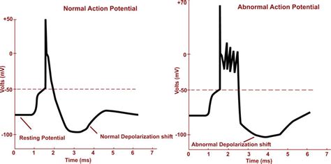 Action Potential In Normal And During Seizure Activity Download