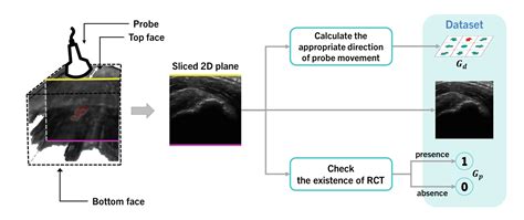 Usg Net Deep Learning Based Ultrasound Scanning Guide For An Orthopedic Sonographer Macslab