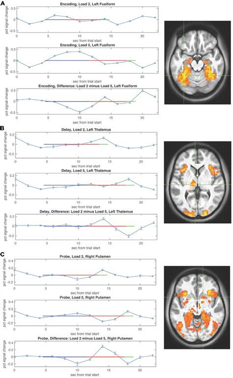 Functional Magnetic Resonance Imaging Fmri Timecourses As A Function