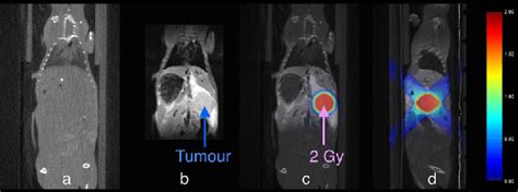 A Coronal View Of CT Image From The RT System B MR Image Registered Download Scientific