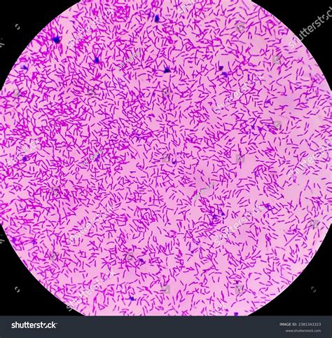 Lo Mejor En La Categoría «e Coli Lactose Fermentation De Imágenes