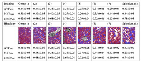 Mapping Tissue Microstructure — Neuropoly Documentation