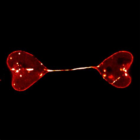 Semi Separated Nuclei Of Two Cells Form A Heart To Heart Shape The Nuclei Were Labeled By Lamin