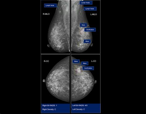 Vindr Solutions For Medical Data