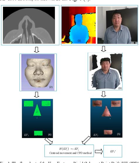 Figure 1 From A Spatial Registration Method Based On Rigid Coherent Point Drift Of Key Features