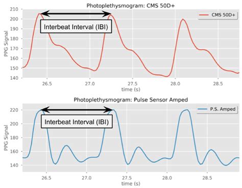 diy ppg comparison of waveform parameters from open source vs