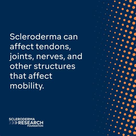 Dimitra Κ Bonia On Linkedin Scleroderma Or Systemic Sclerosis Is A Rare Disease And