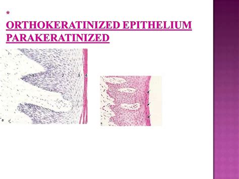 Microscopic Features Of Gingiva Ppt