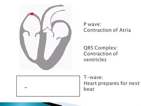 St Segment Analysis Stan For Intrapartum Electronic Fetal Monitoring Ppt St Segment Analysis Stan For Intrapartum Electronic Fetal Monitoring Ppt