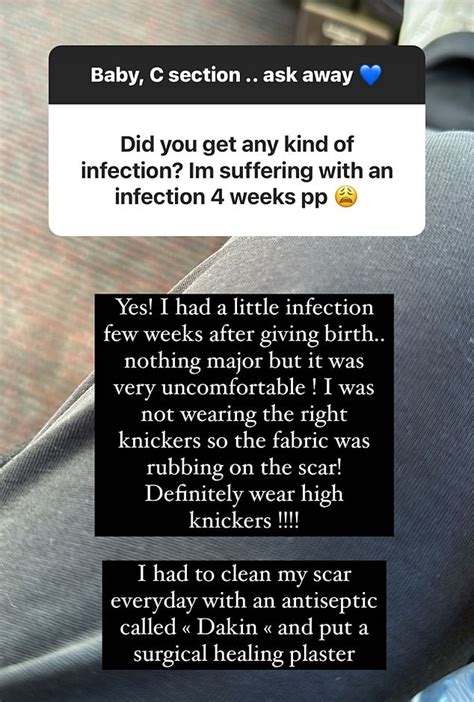 Maeva D Ascanio Talks Candidly About Having Son Beau Via A C Section Daily Mail Online