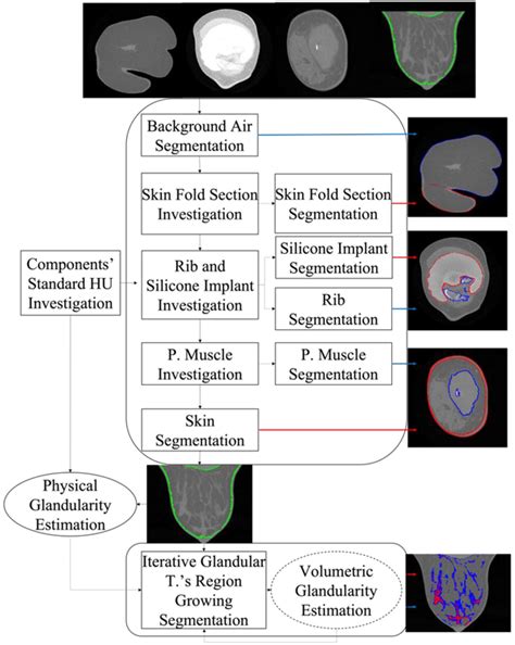 Framework Of The Proposed Segmentation Method Download Scientific Diagram