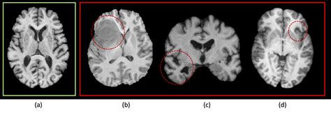 symmetry awareness encoded deep learning framework for brain imaging