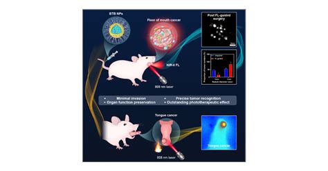 Enhancing Nir Ii Imaging And Photothermal Therapy For Improved Oral Cancer Theranostics By