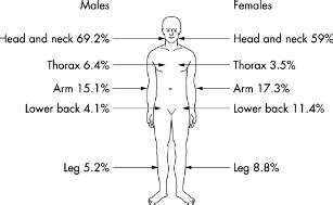 R Plot Human Body In 2d Stack Overflow