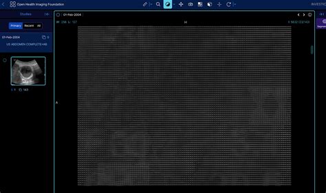 Bug V3 And V2 Rgb Inconsistencies · Issue 3354 · Ohifviewers · Github