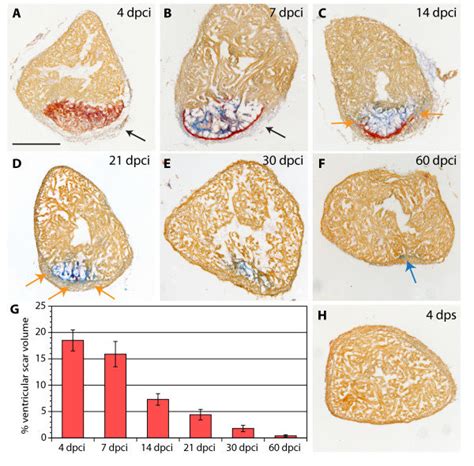 Scar Formation And Resorption During Healing Of Myocardial Infarction Download Scientific