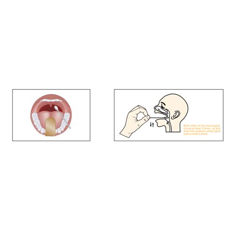 Sars Cov 2 Antigen Rapid Test Soma