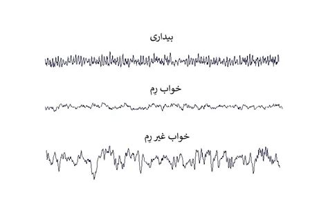 خواب رِم Rem چیست و چگونه آن را اندازه‌گیری کنیم؟ • دیجی‌کالا مگ