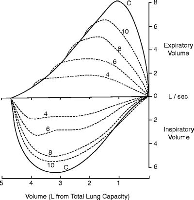 Physiology Of Fixed Airway Obstruction Radiology Key