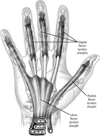 Getting A Hand Le On Pyogenic Flexor Tenosynovitis — Brown Emergency