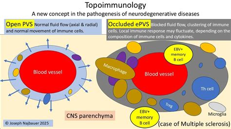 Topoimmunology Spatial Constraints In Cns Immune Regulation And Autoimmune Responses