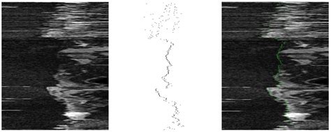 Deep Learning For Boundary Detection In Model Based Segmentation Hans Lamecker