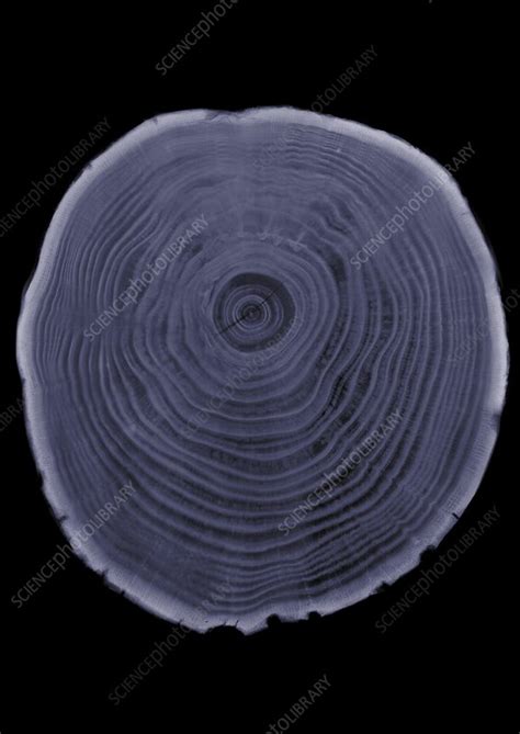 Tree Trunk Cross Section X Ray Stock Image F029 9104 Science Photo Library