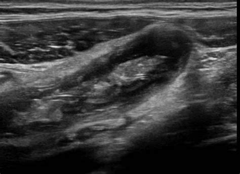 Pediatrics 9 1 Pediatric Abdomen And Retroperitoneum Case 9 1 7
