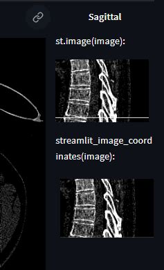 New Tiny Component Streamlit Image Coordinates Custom Components Streamlit