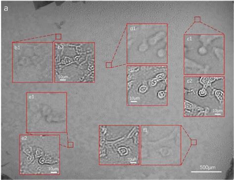 large fov and high throughput srgan enabled contact imaging a